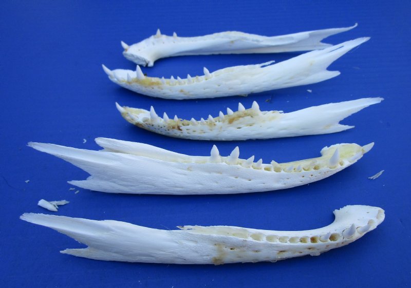 Jawbone Diagram